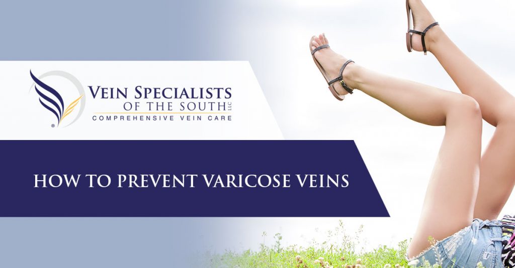 How to Prevent Varicose Veins - Vein Specialists of the South